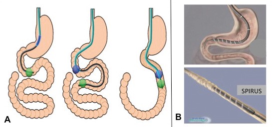 côlon - Hôpital Saint-Antoine AP-HP