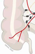 appendice - Service de chirurgie générale et digestive Hôpital Saint ...